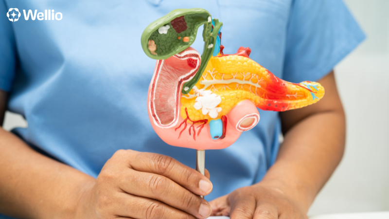 The Green Truth: Unraveling the Mystery Behind Your Green Bowel Moveme ...